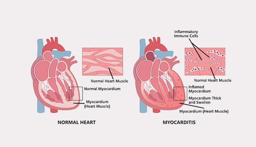 Cardiac Diseases – Asim Hameedi, MD