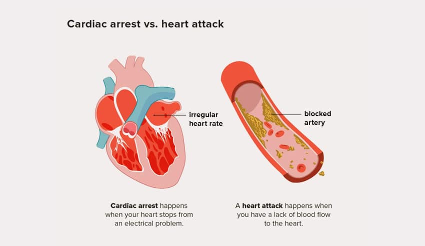 Cardiac Diseases – Asim Hameedi, MD